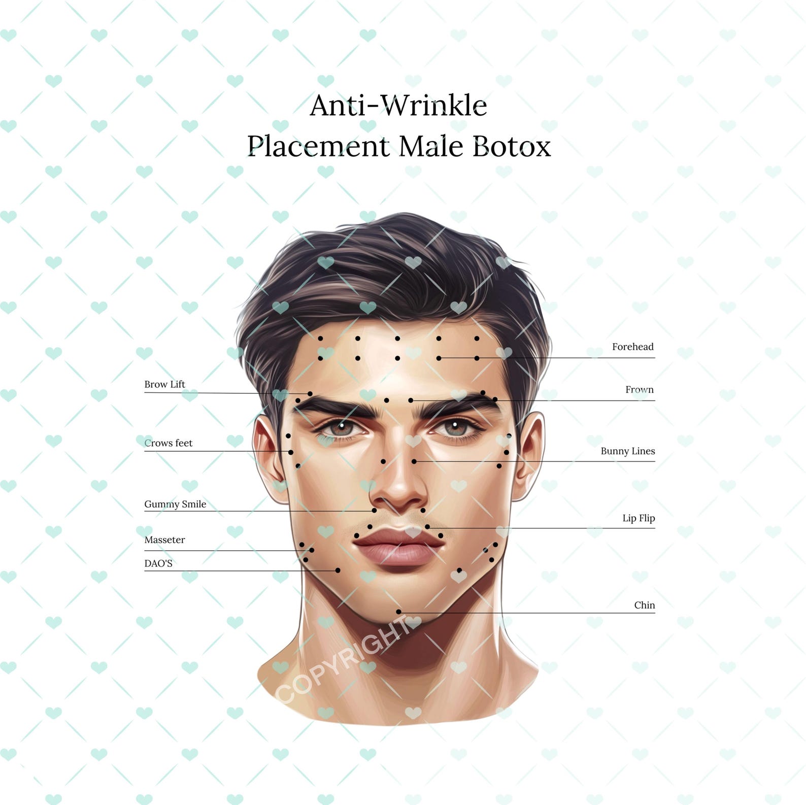 Male Botox Injection Points on Muscle Anatomy PNG| Botox & Filler ...