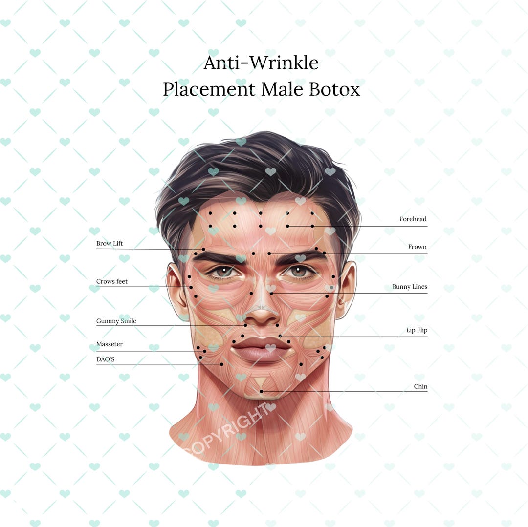 Male Botox Injection Points on Muscle Anatomy PNG| Botox & Filler ...