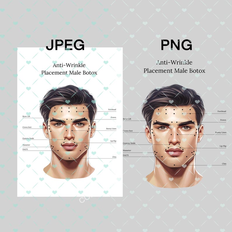 Male BOTOX Injection Points Bundle | Botox & Filler Injector | Anatomy ...