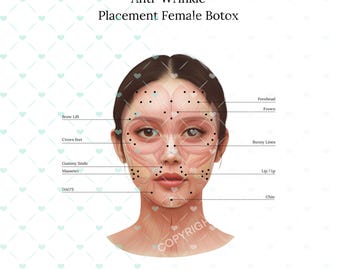 Botox Injection Points on Muscle Anatomy | Botox & Filler Injector ...