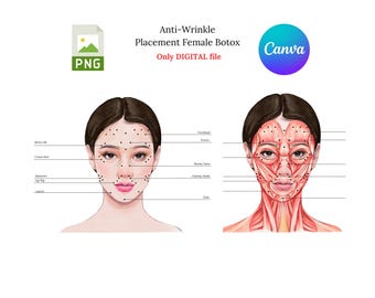 Botox Injection Points on Muscle Anatomy | Botox & Filler Injector ...