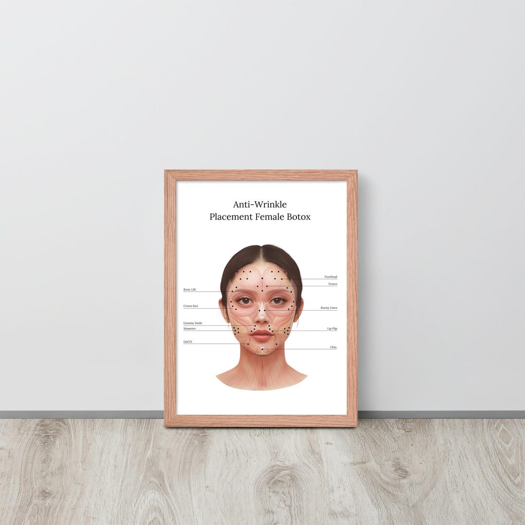 Botox Injection Points Bundle Framed | Botox & Filler Injector ...