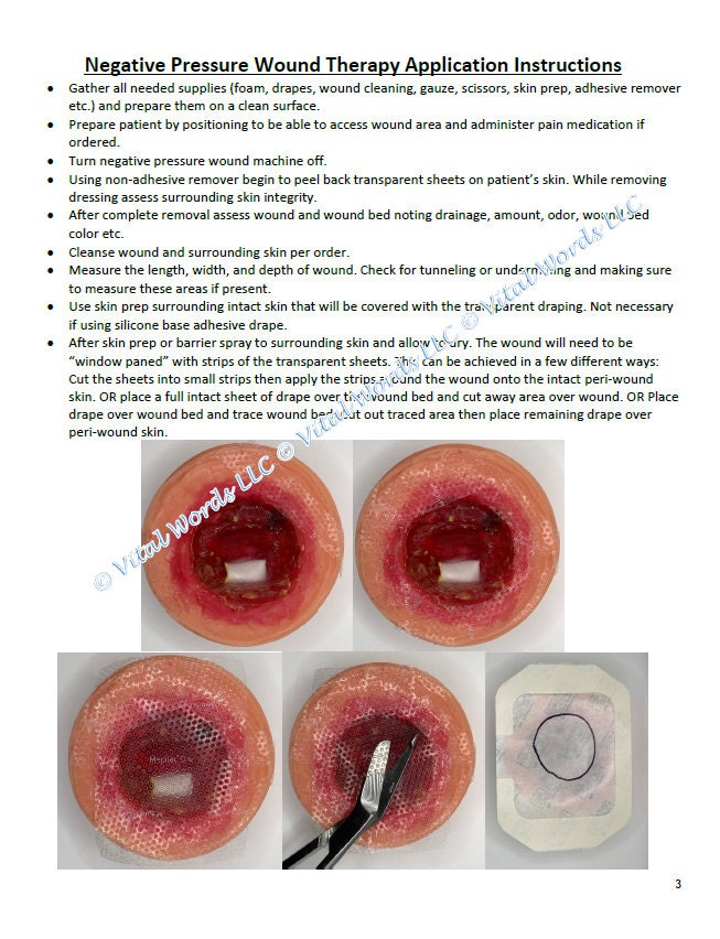 Negative Pressure Wound Therapy Instructions With Photos - Etsy