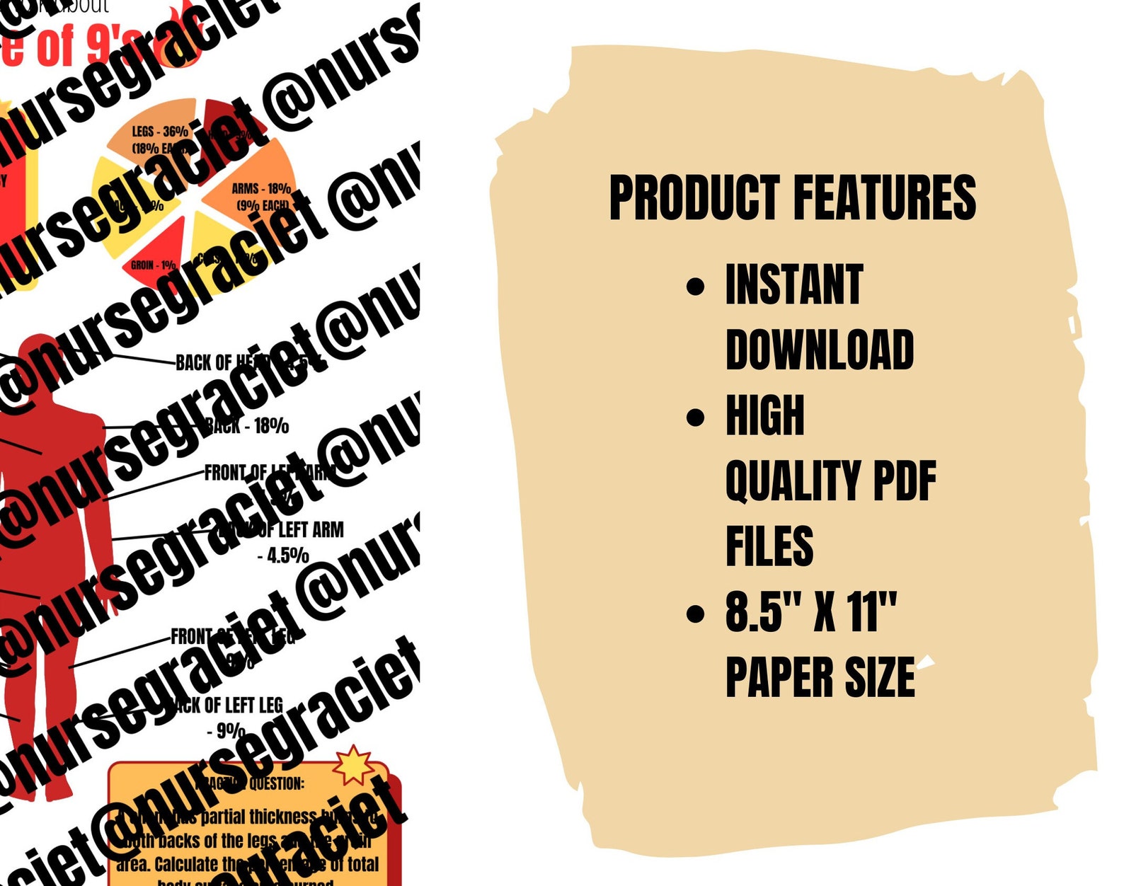 RULE OF 9's Burn Calculation Method - Nursing School Notes - Next Gen ...