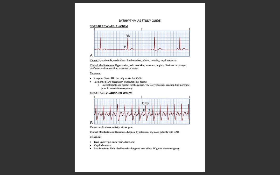 21-page Comprehensive Cardiac Care and Dysrhythmias Study Guide ...