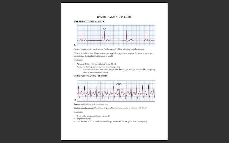 21-page Comprehensive Cardiac Care and Dysrhythmias Study Guide ...