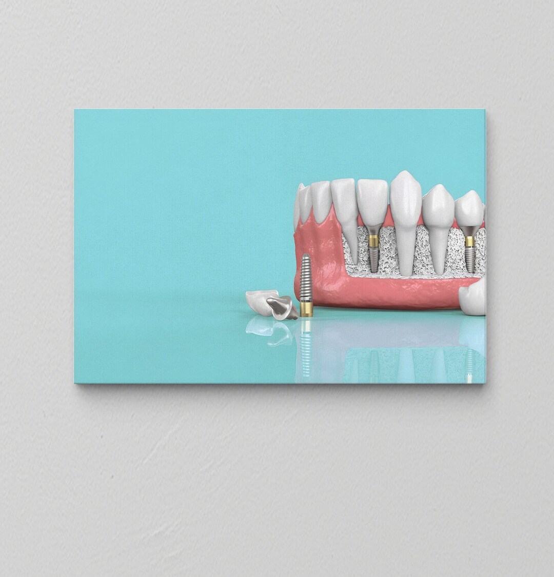 Dental Clinic Poster / Hospital Wall Decor / Teeth Paintings / Dentist ...