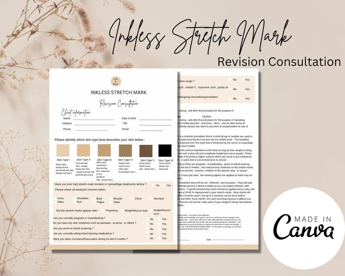 Stretch Mark Removal , Esthetician Form , Inkless Stretch Mark Revision ...