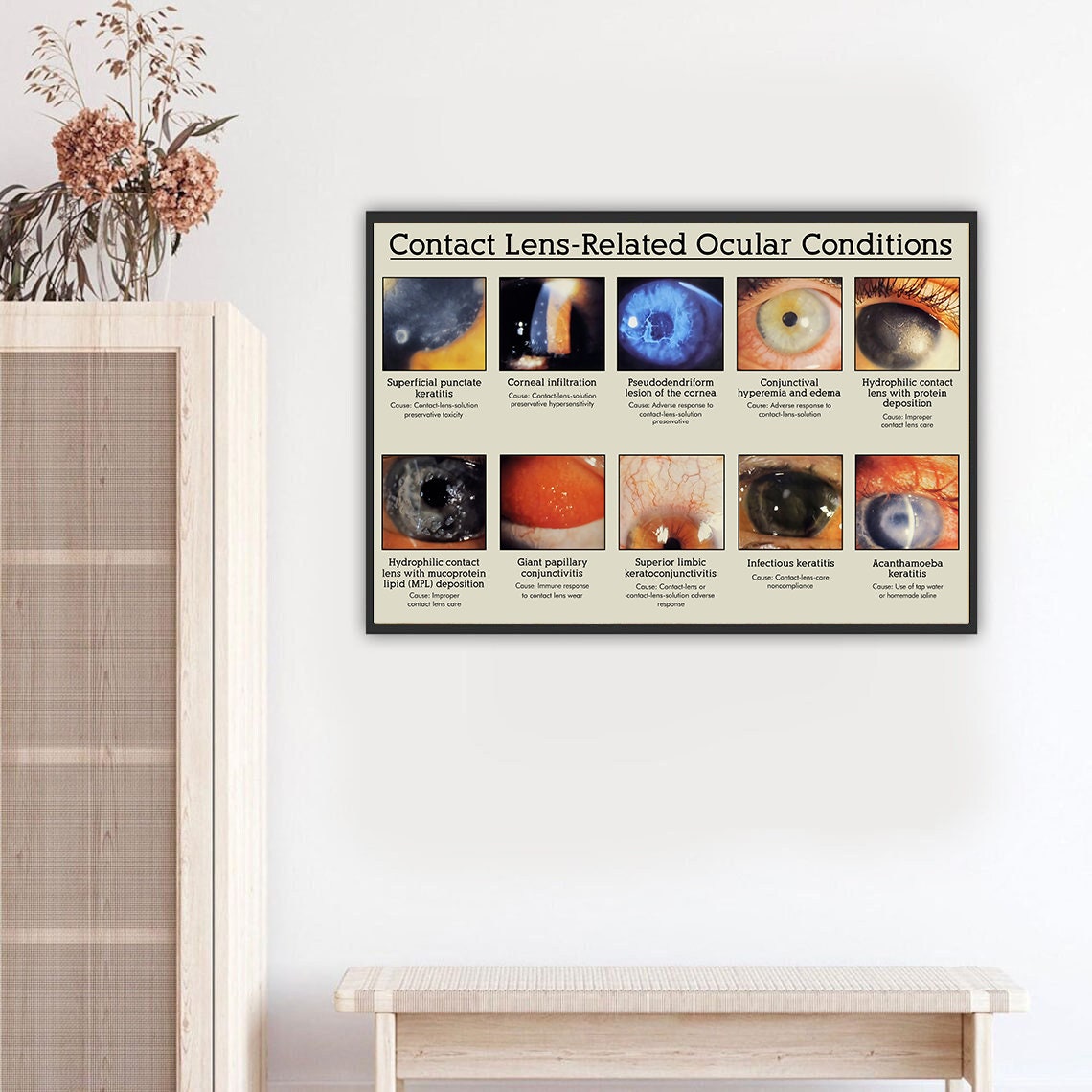 Disturbing Eye Poster Contact Lens Anatomy Pull Down Chart Physiology ...