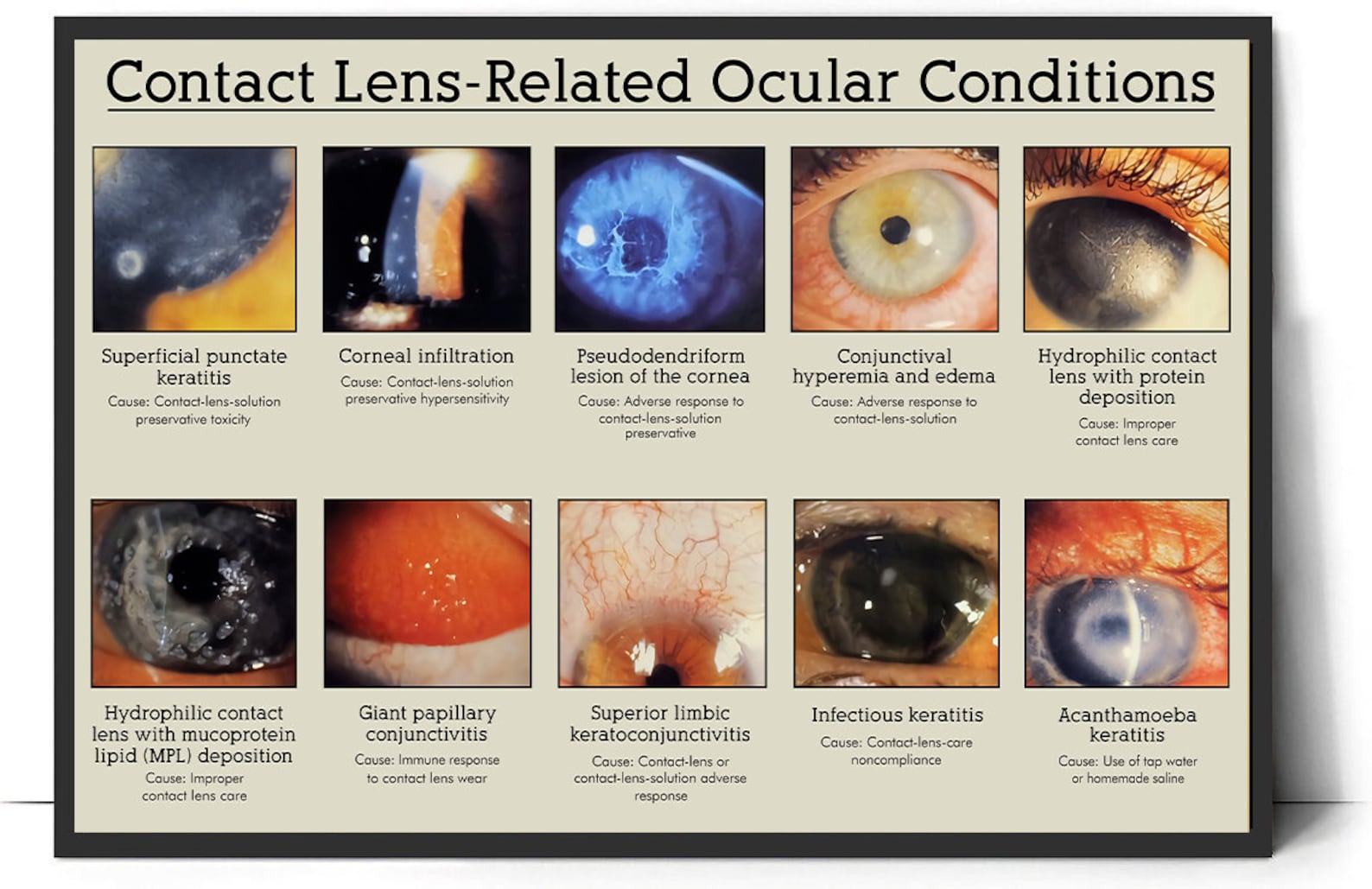 Disturbing Eye Poster Contact Lens Anatomy Pull Down Chart Physiology ...