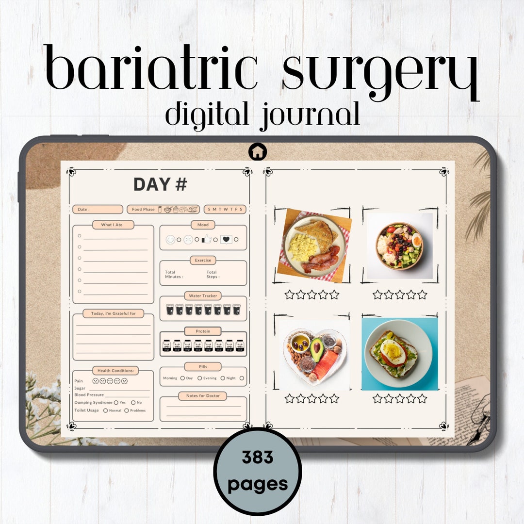 Ultimate Bariatric Surgery Planner Gastric Sleeve Post-op Journal RNY ...