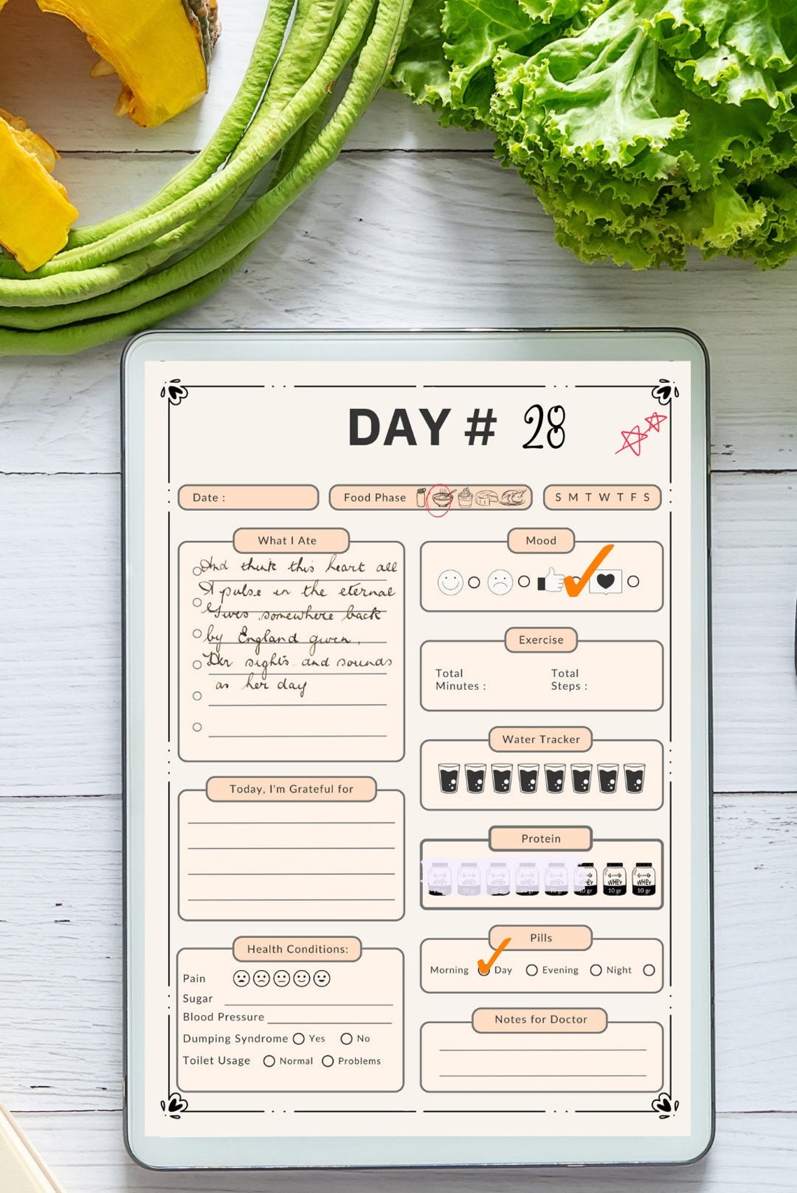 Ultimate Bariatric Surgery Planner Gastric Sleeve Post-op Journal RNY ...