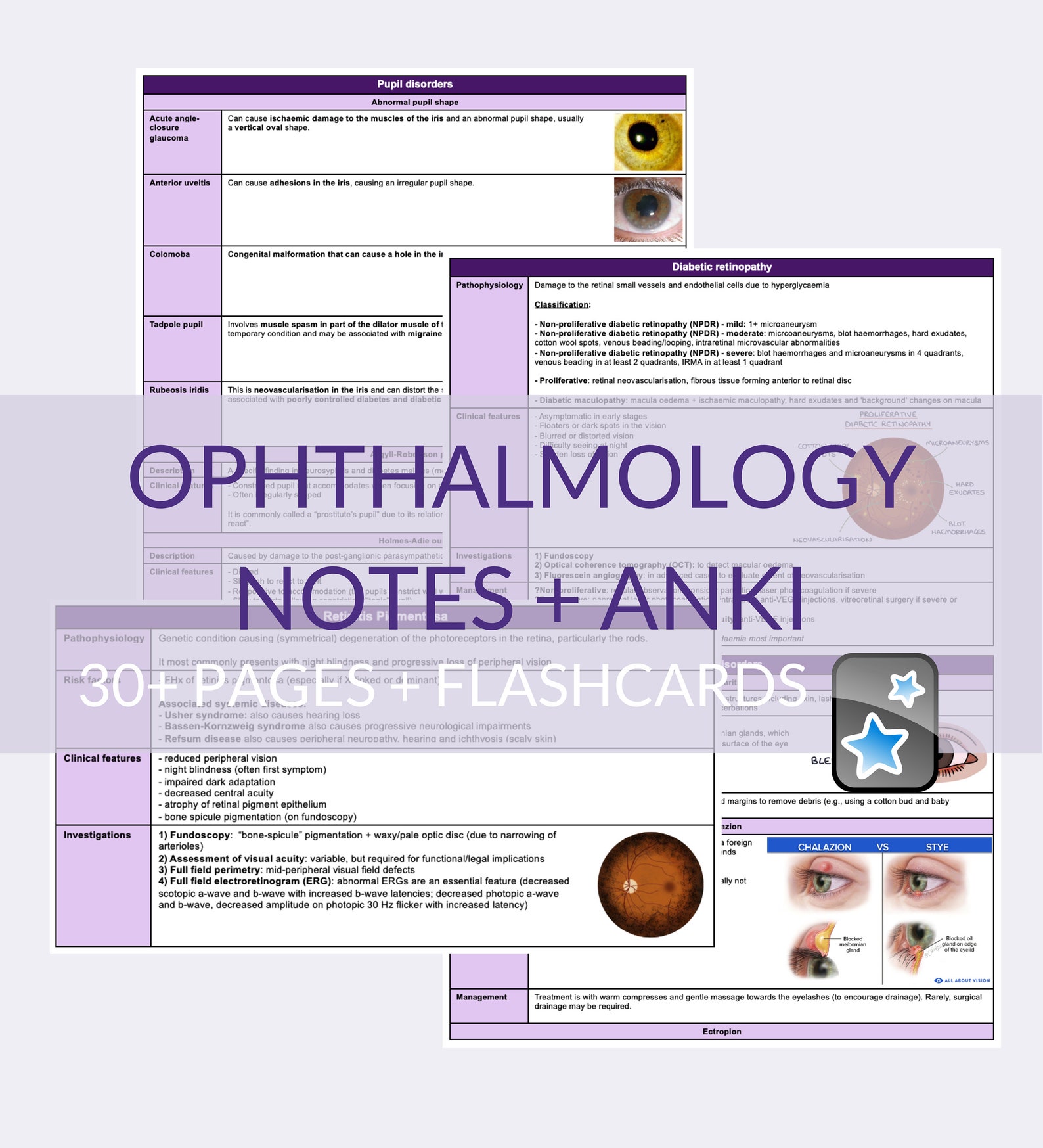 Ophthalmology Conditions With Flashcards | Medical School Study Guide ...