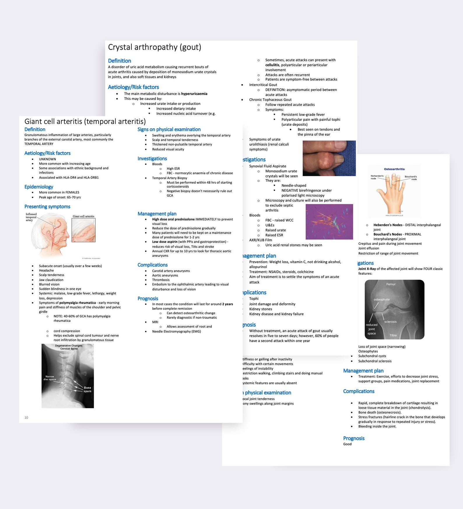 Musculoskeletal (MSK) Conditions With Flashcards | Medical School Study ...