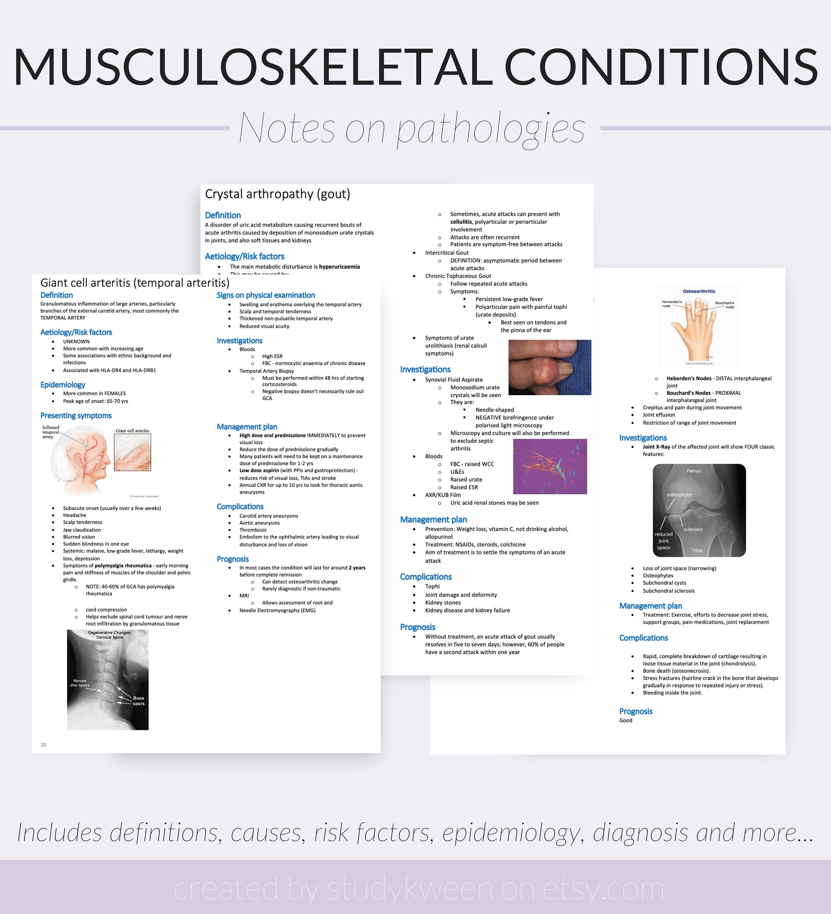 Musculoskeletal MSK Conditions With Flashcards Medical School Study ...