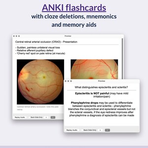 Ophthalmology Conditions With Flashcards | Medical School Study Guide ...