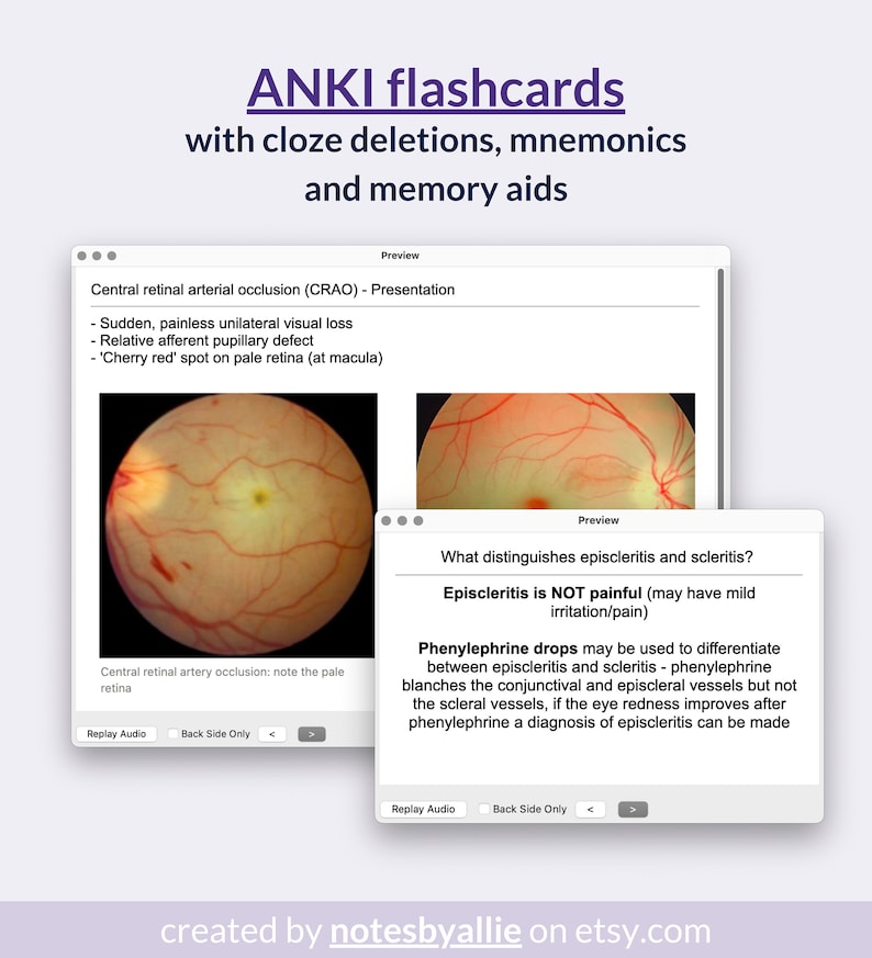 Ophthalmology Conditions With Flashcards | Medical School Study Guide ...