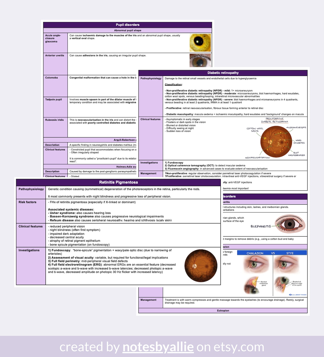 Ophthalmology Conditions With Flashcards | Medical School Study Guide ...