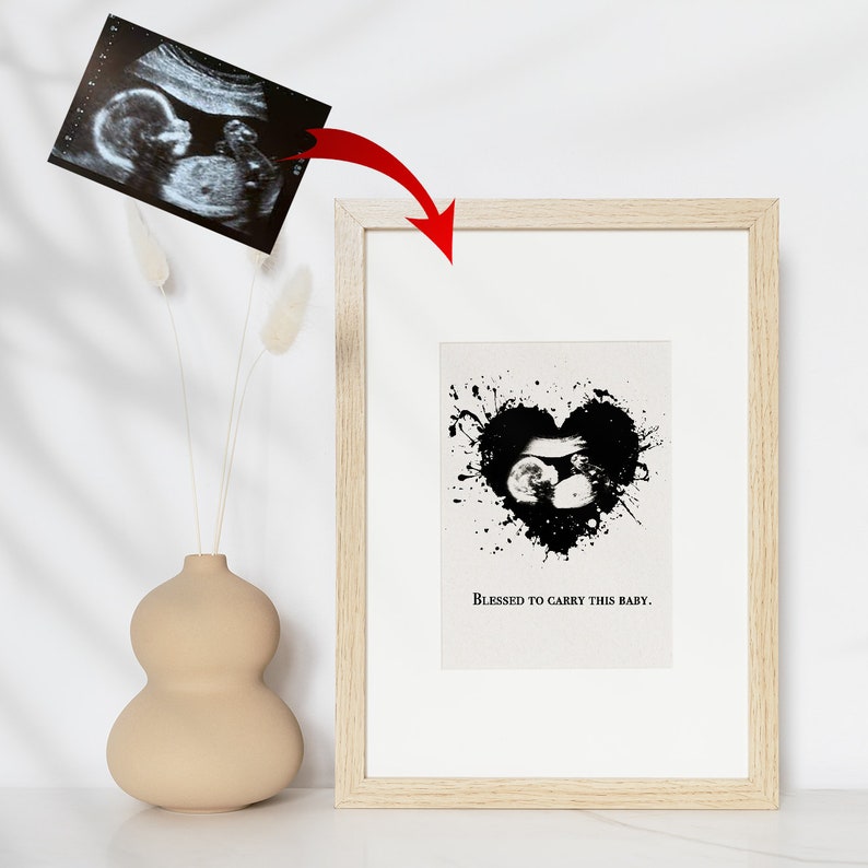 Watercolor Ultrasound Pregnancy Scan Print Baby Shower - Etsy