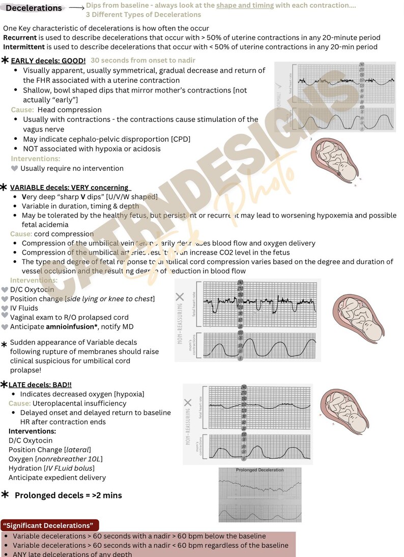 Fetal Heart Rate Monitoring Guide - Etsy