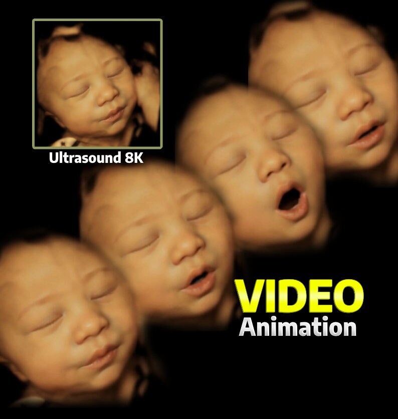 Ultrasound8k VIDEO Animation. Convert Your REALISTIC Ultrasound8k to Video Animation With Your ...
