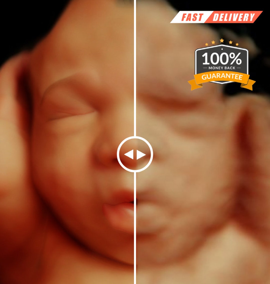3D, 4D, and 5D HD Ultrasound. Transform Your Ultrasound Scan and ...
