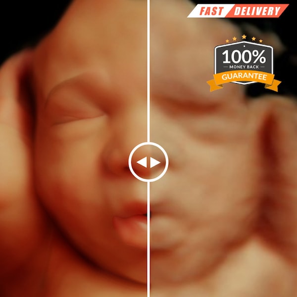 3d Pregnancy Scan - Etsy UK