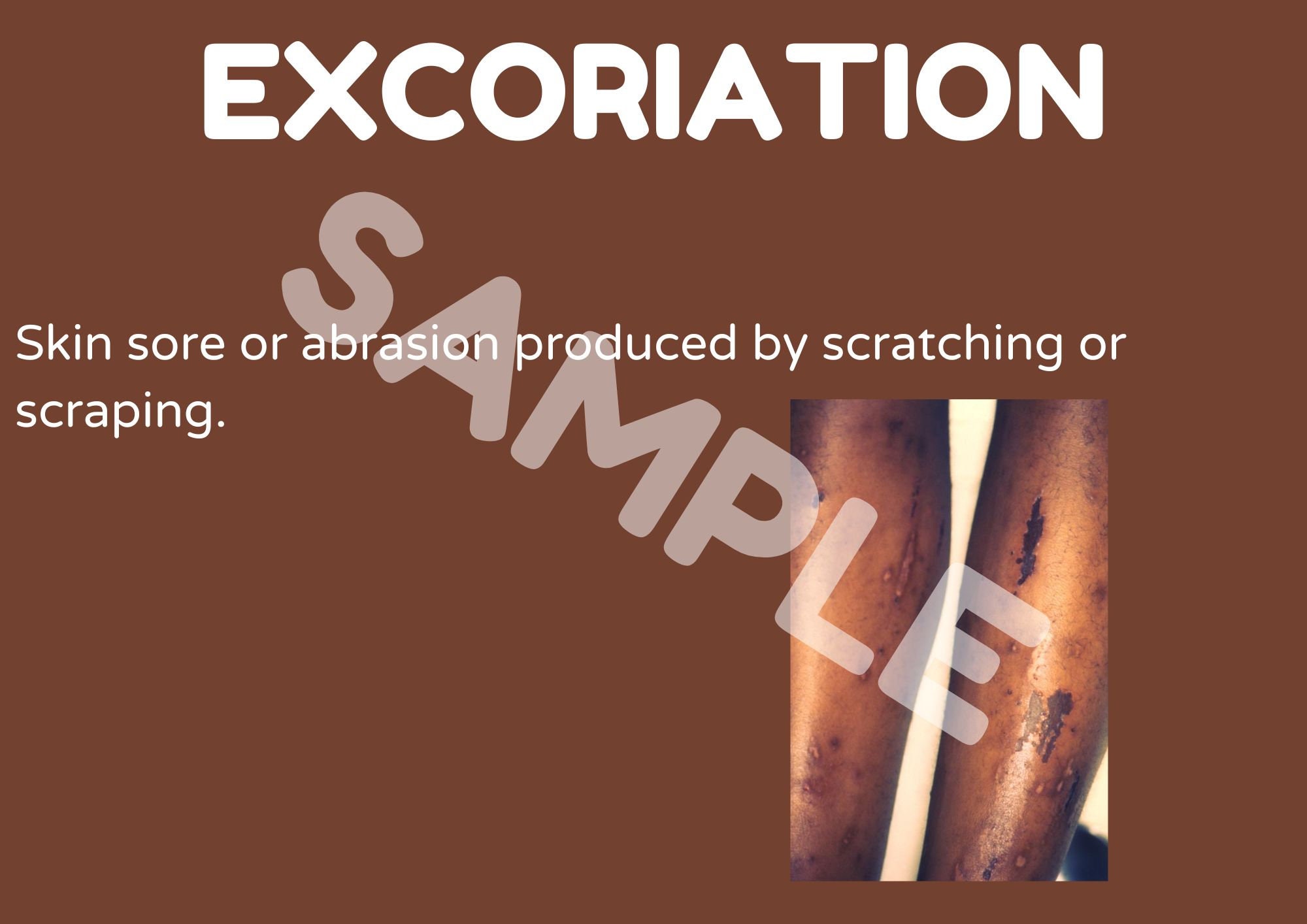 Dermatology Flashcards - Skin Lesions Below the Skin - Etsy