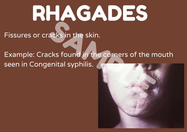 Dermatology Flashcards - Skin Lesions Below the Skin - Etsy