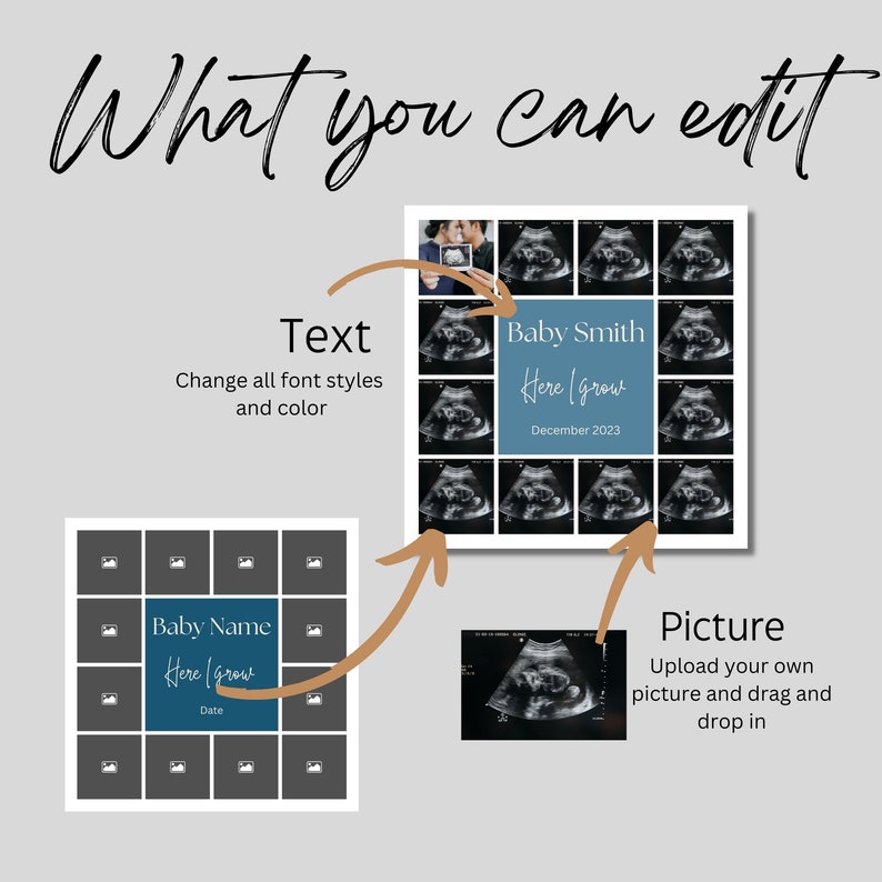 Baby Ultrasound Collage Template| Pregnancy |parents to Be| Unborn Baby ...