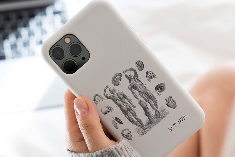Anatomy Science iPhone Case, Anatomy X-ray Gift, Medical Student ...