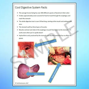Digestive System Science Webquest Internet Activity - Editable DIGITAL ...