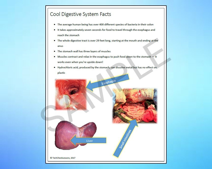 Digestive System Science Webquest Internet Activity - Editable DIGITAL ...