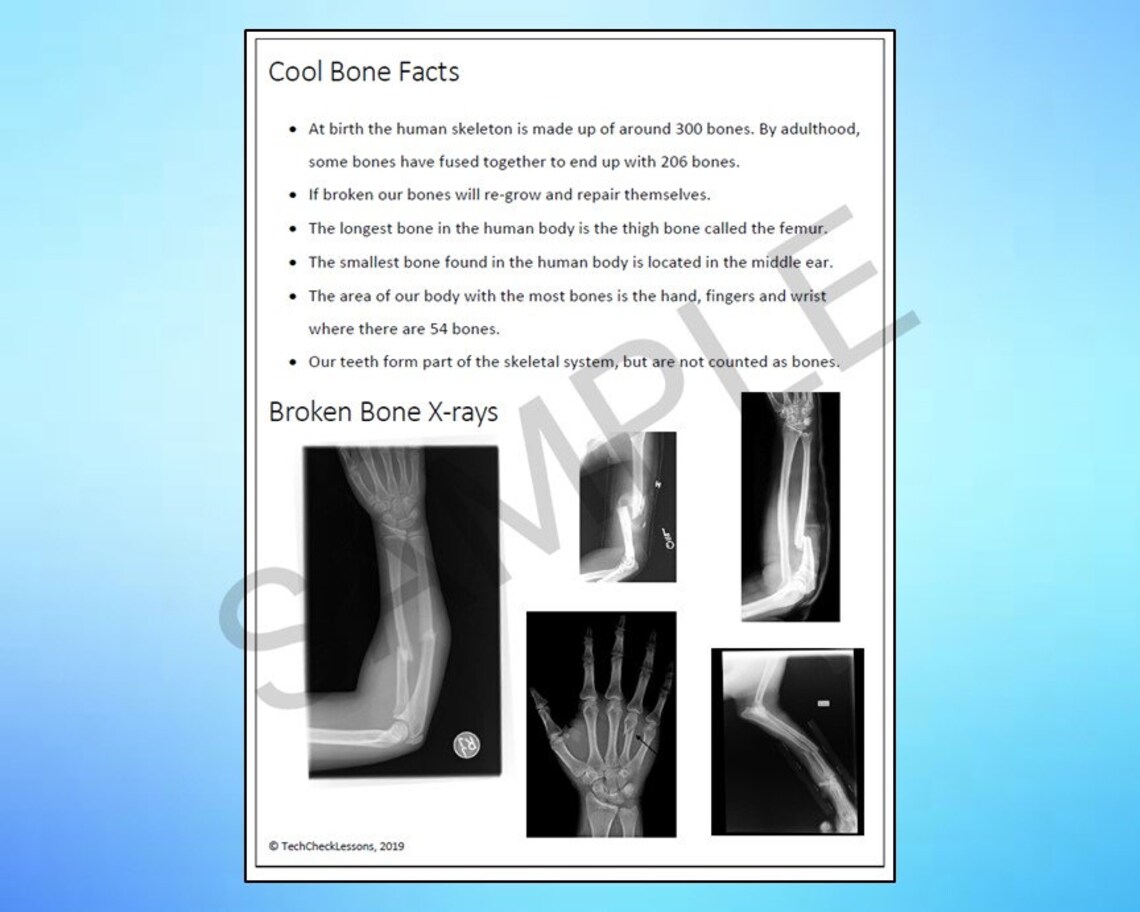 Skeletal System Science Webquest Internet Activity - Editable DIGITAL ...