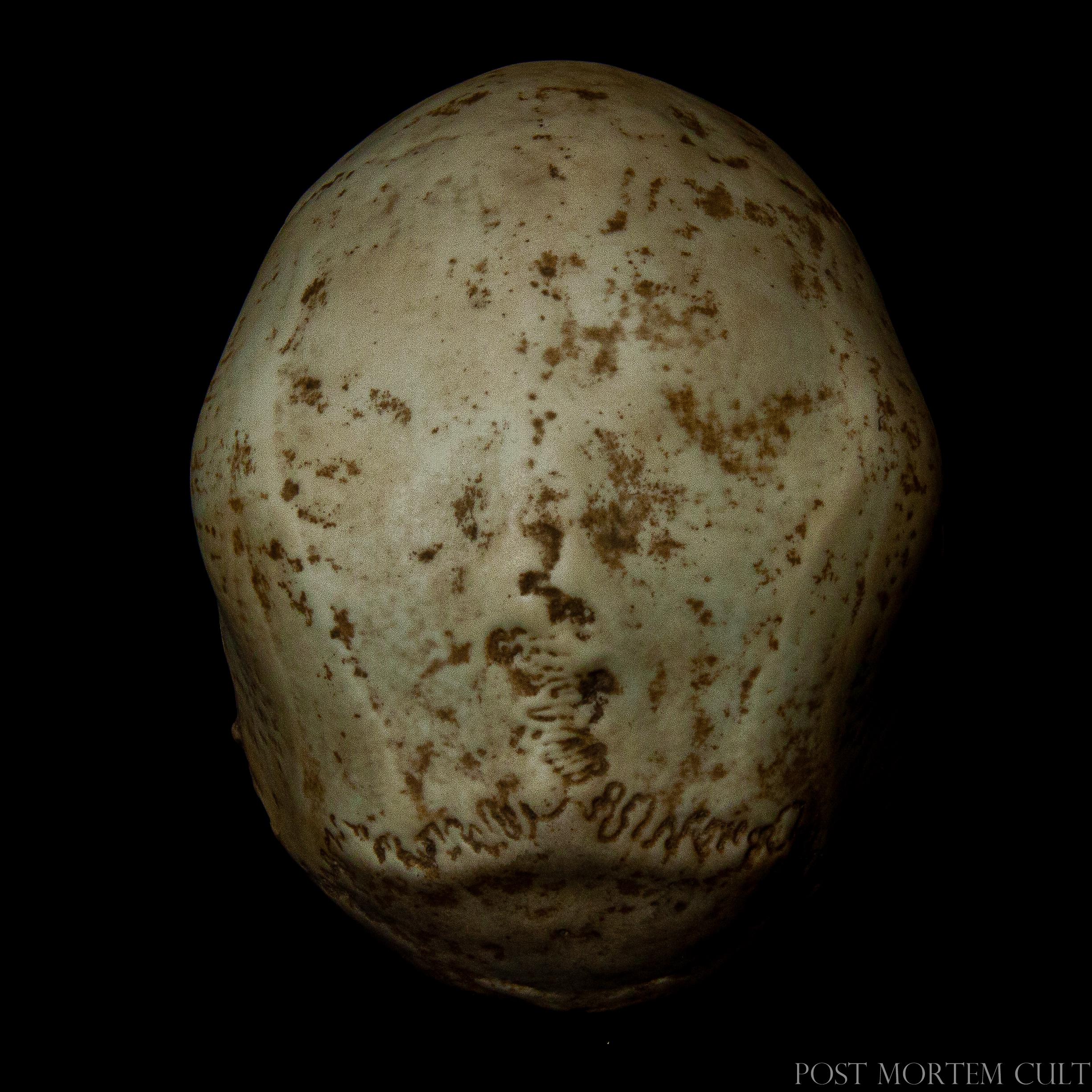 Rudolf Skull -realistic Human Skull Replica - Ossuary Decor - Life-size ...