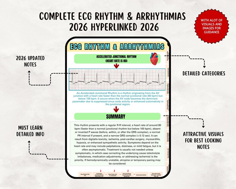 ECG Rhythm & Arrhythmias Study Guide: Nursing School EKG Cheat Sheet ...