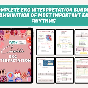 EKG Interpretation Nursing Study Guide: Cardiac Rhythms Cheat Sheet ...