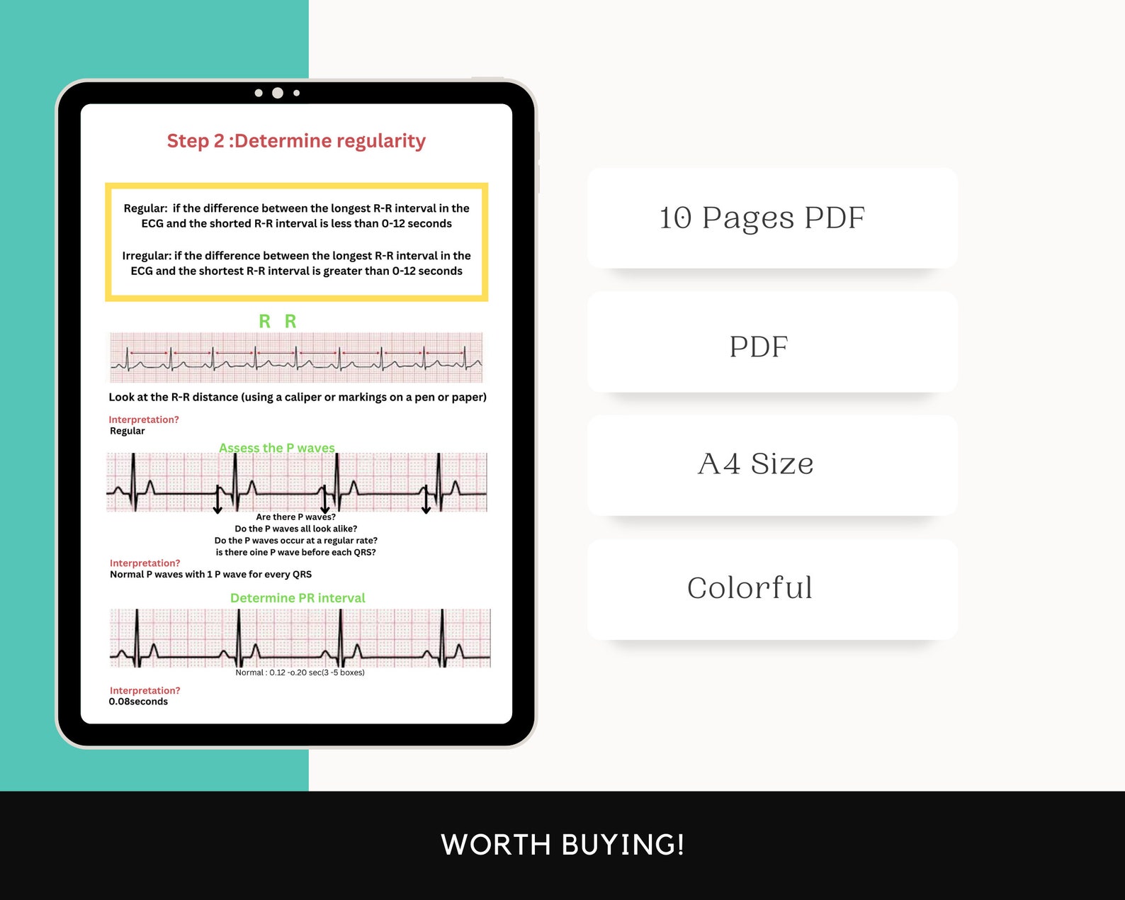 EKG Interpretation Nursing Study Guide, Cardiac Rhythms Cheat Sheet ...