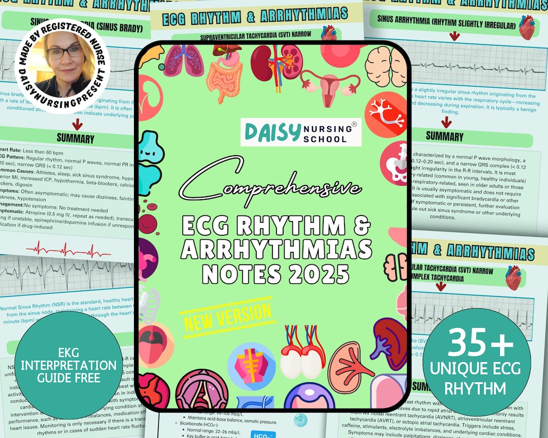 EKG ECG Rhythm and Arrhythmias Interpretation, Nursing School Cardiac ...