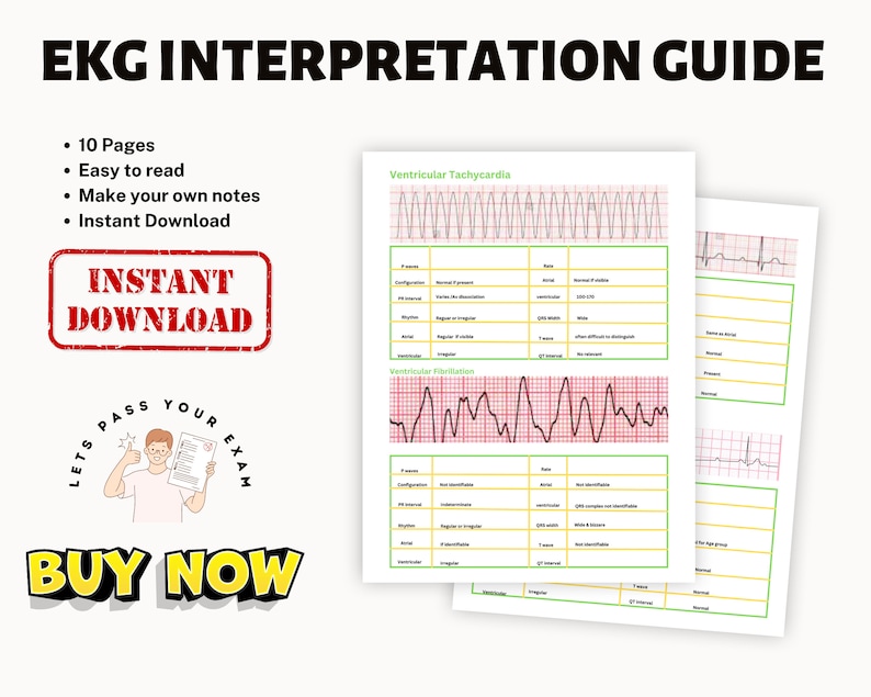 EKG Interpretation Nursing Study Guide, Cardiac Rhythms Cheat Sheet ...