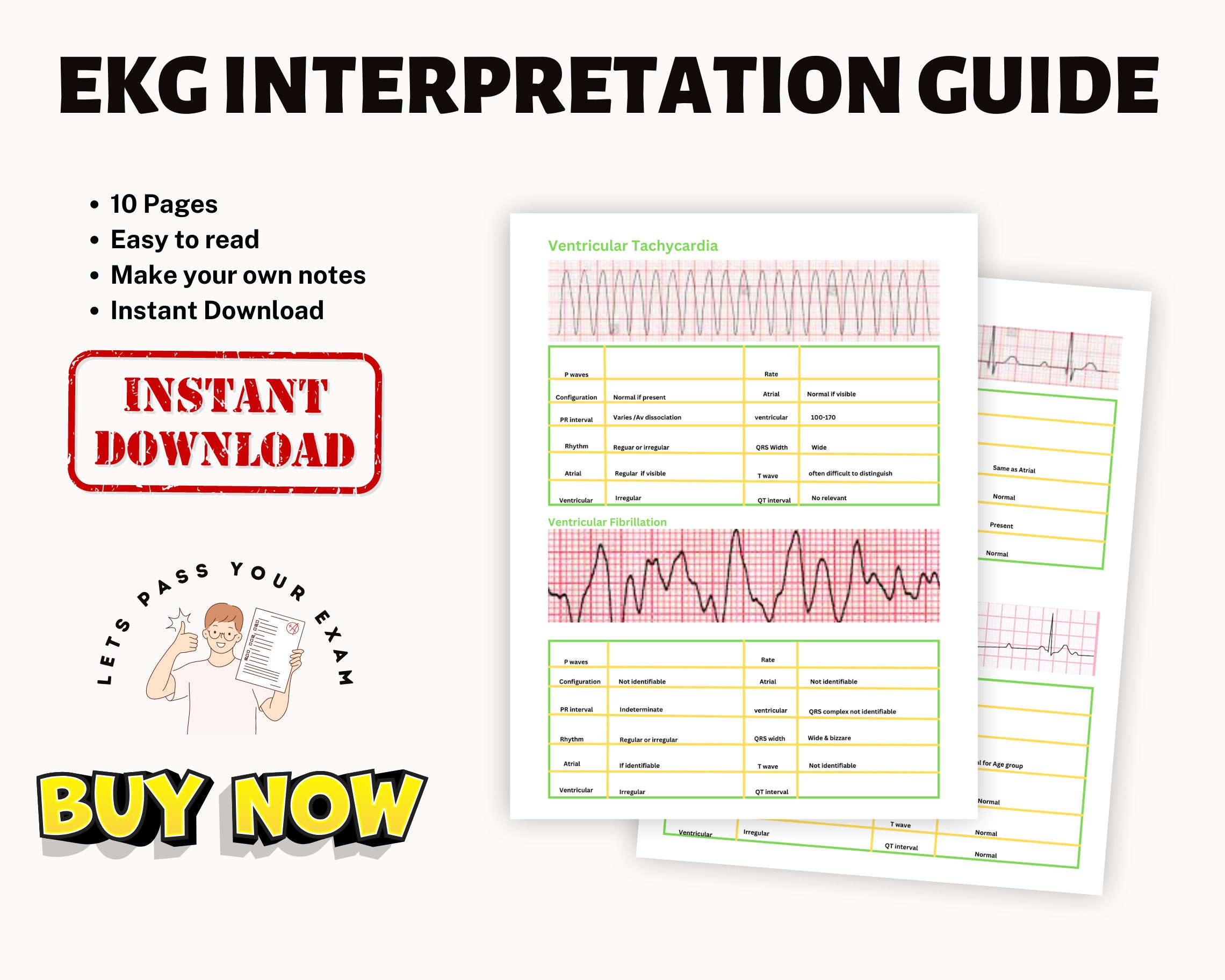 EKG Interpretation Nursing Study Guide, Cardiac Rhythms Cheat Sheet ...