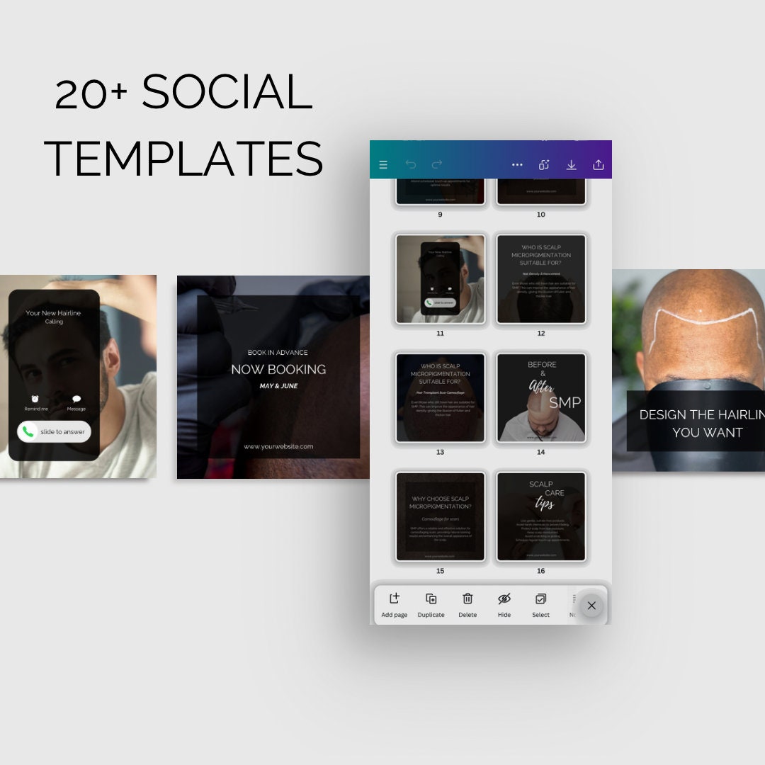 DIY SMP Social Templates | Scalp Micropigmentation Designs | Hair ...