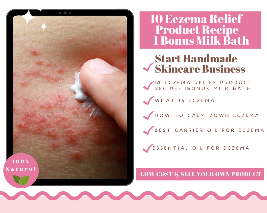 DIY Eczema Relief Product Recipe, Make It Yourself, Handmade Skincare ...
