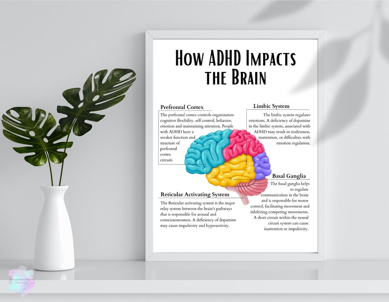 How ADHD Impacts the Brain Attention-deficit/hyperactivity Disorder ...