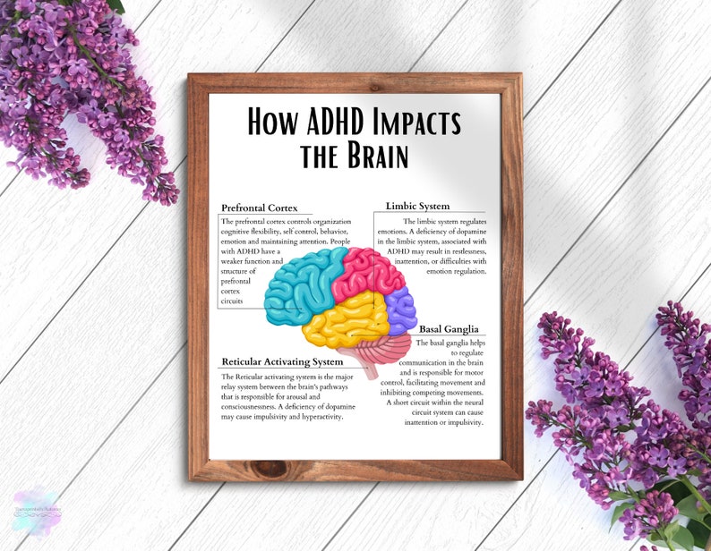 How ADHD Impacts the Brain Attention-deficit/hyperactivity Disorder ...