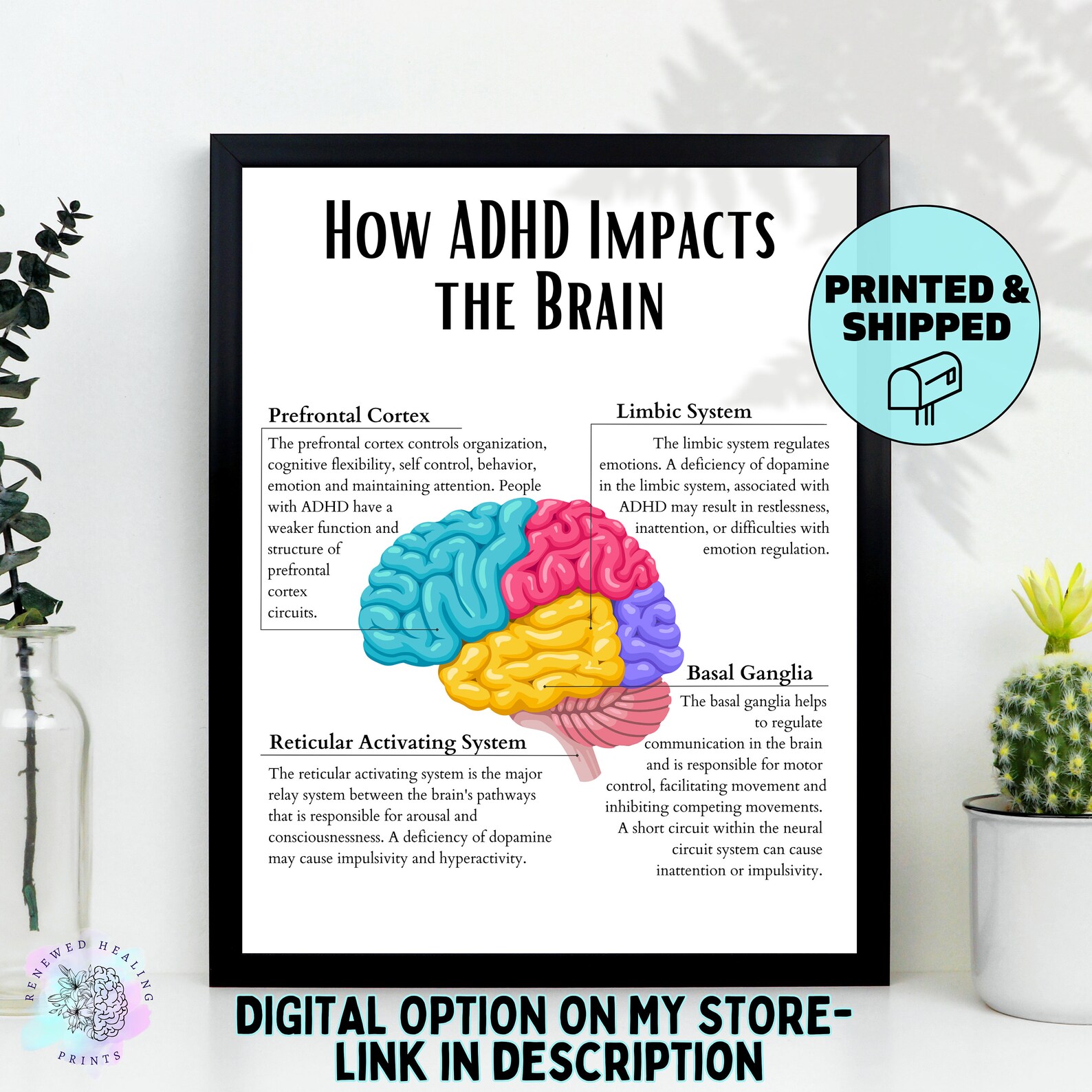 How ADHD Impacts the Brain Attention-deficit/hyperactivity Disorder ...