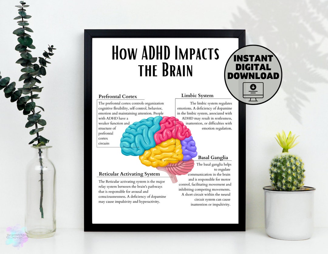 How ADHD Impacts the Brain Attention-deficit/hyperactivity Disorder ...