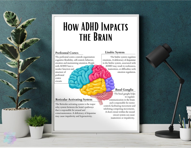 How ADHD Impacts the Brain Attention-deficit/hyperactivity Disorder ...