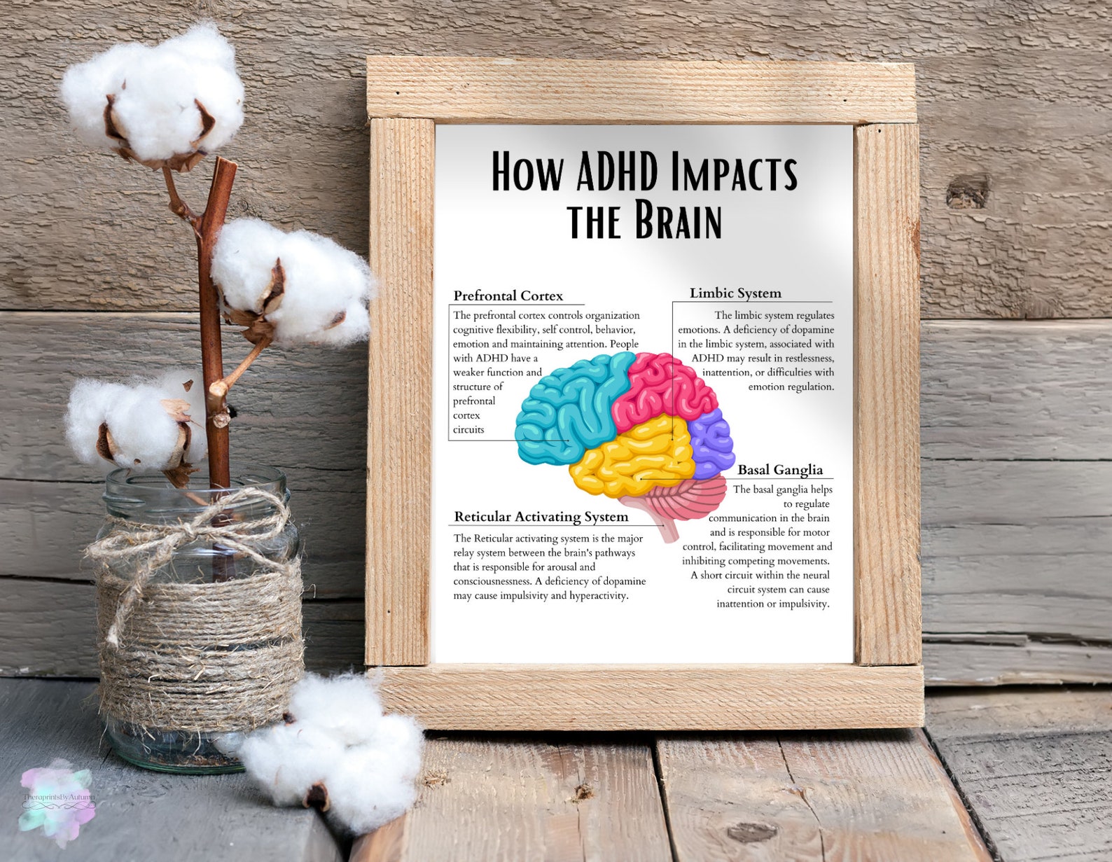 How ADHD Impacts the Brain Attention-deficit/hyperactivity Disorder ...