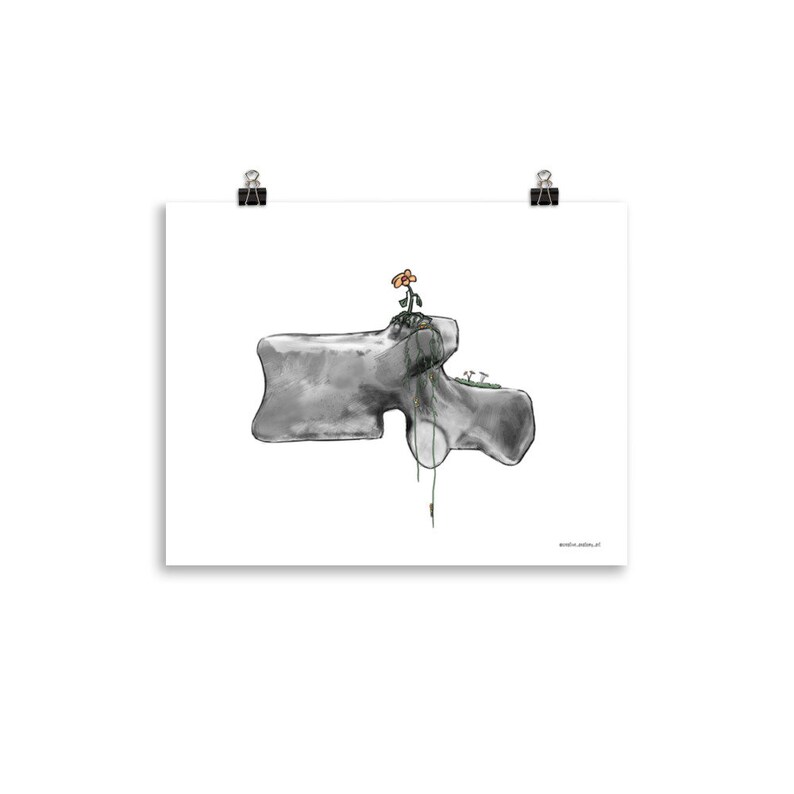 Lumbar Vertebra Poster Without Frame - Etsy